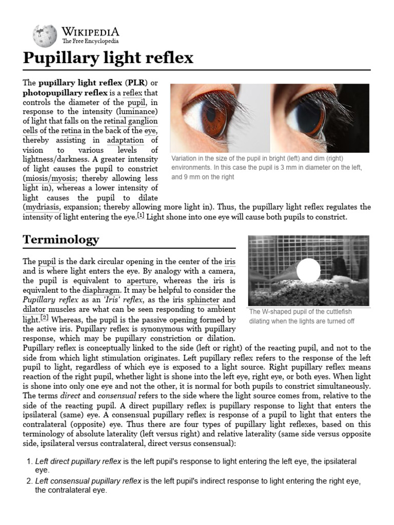 Pupillary Light Reflex - Wikipedia - Https - en - Wikipedia.org - Wiki - Pupillary - Light ...