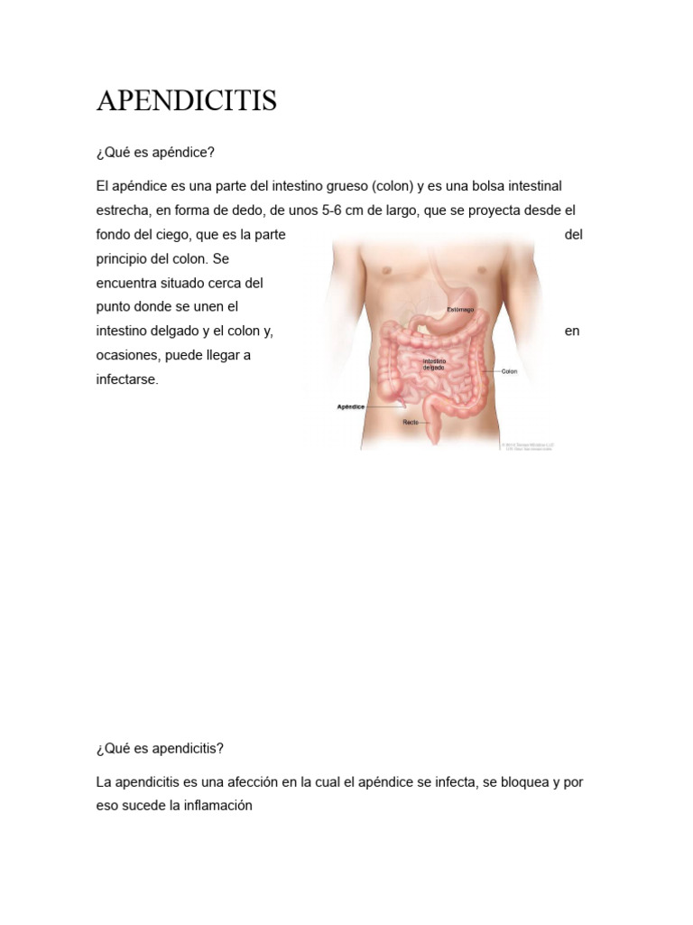 Apendicitis 2 | PDF