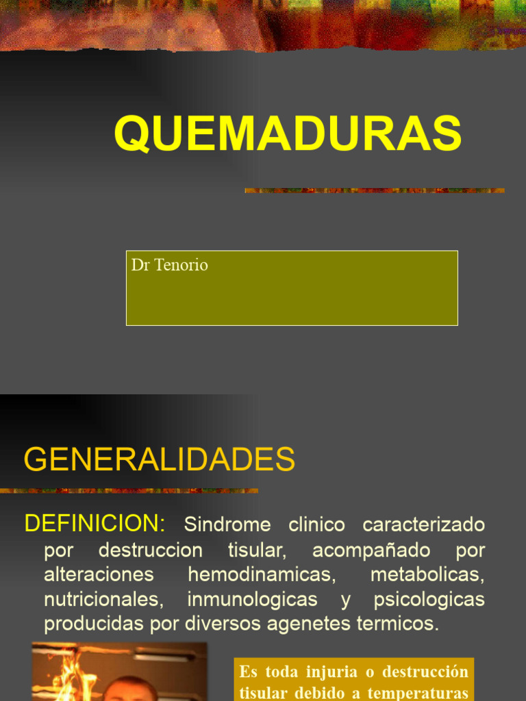Guía Completa sobre Quemaduras | PDF | Quemar | Medicina CLINICA