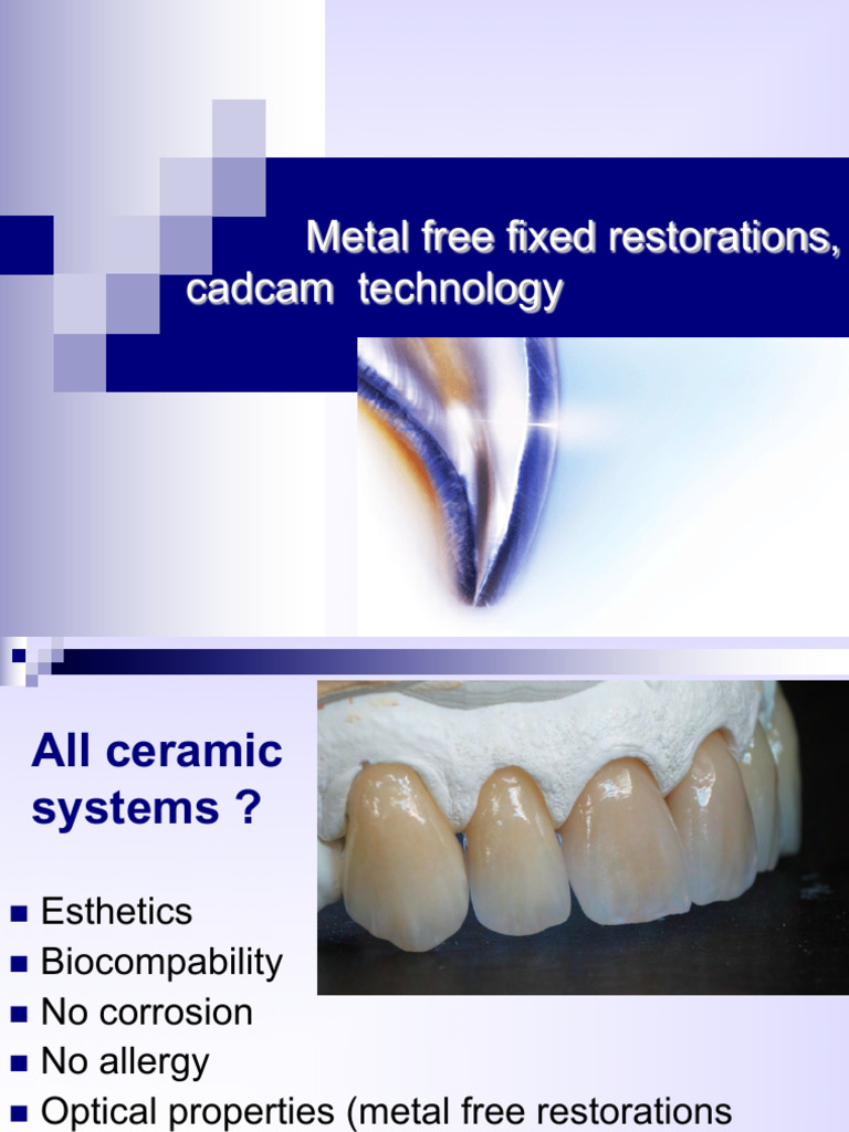 Metal Free Fixed Restorations Cadcam Technology CS | PDF