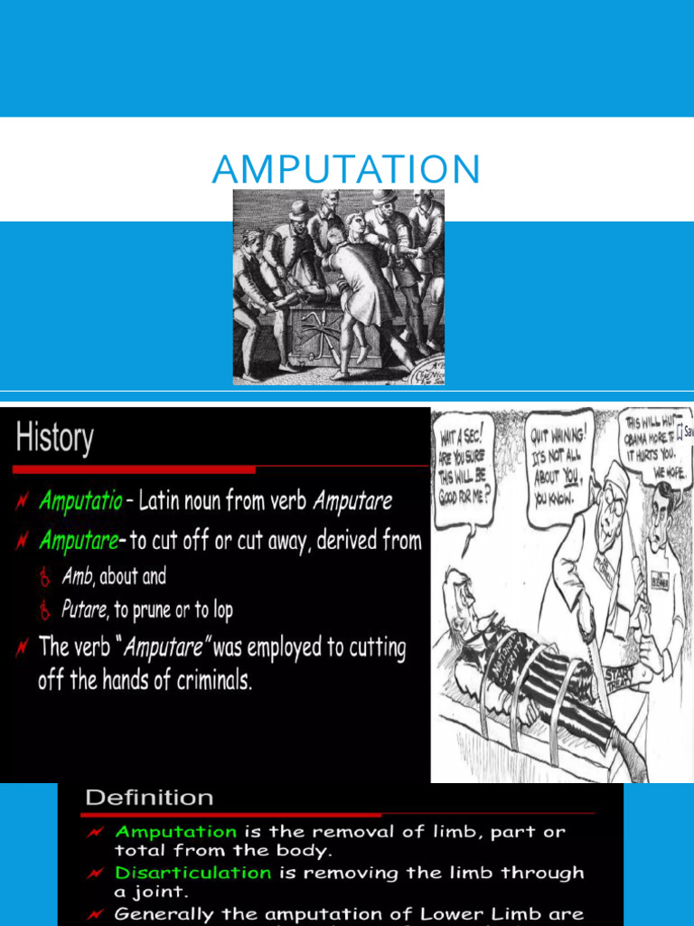 Amputation | PDF | Amputation | Prosthesis