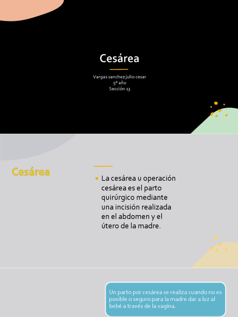 Operación Cesárea Julio Cesar | PDF | Parto | Seccion de cesárea