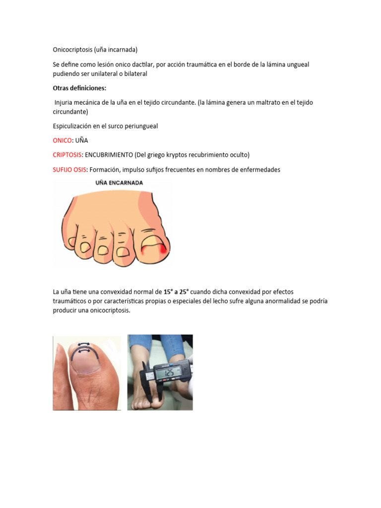 Onicocriptosis | PDF