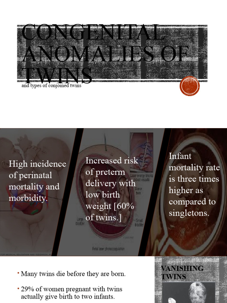 Congenital Anomalies of Twins | Download Free PDF | Twin | Conjoined Twins