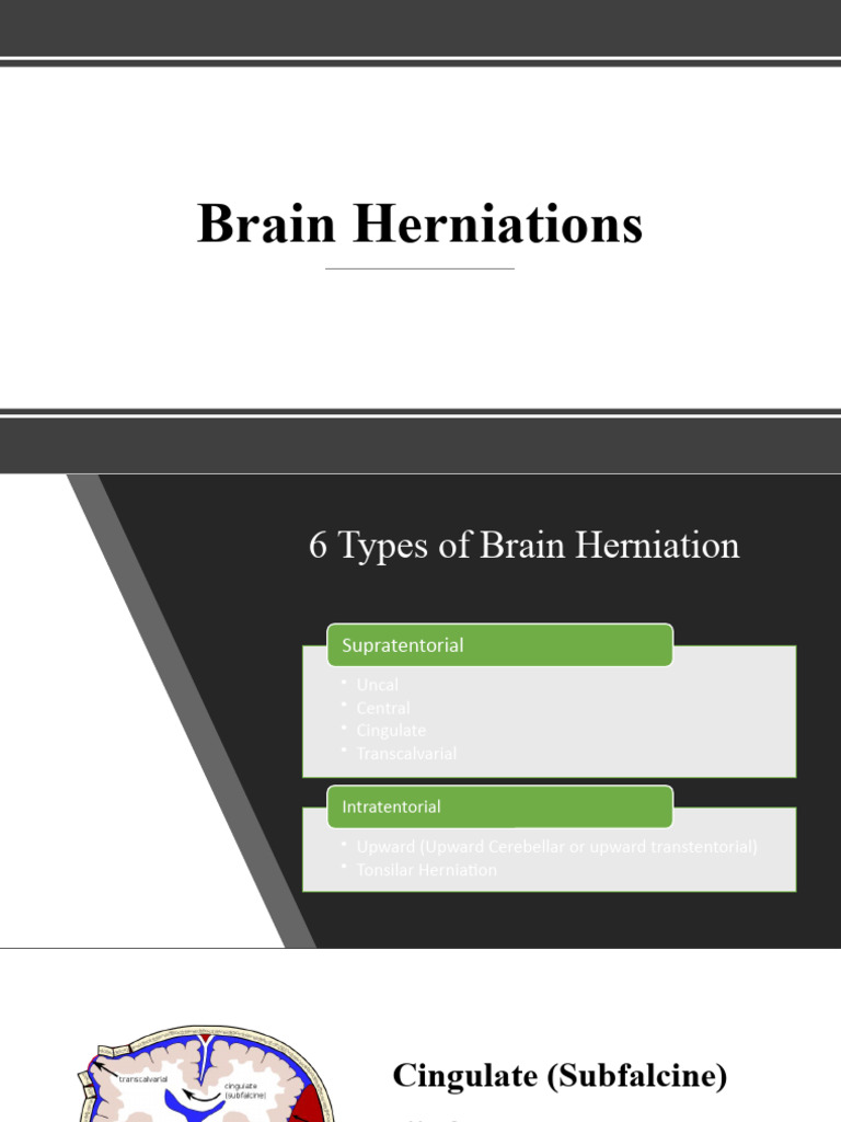 Brain Herniation Types & Details | PDF