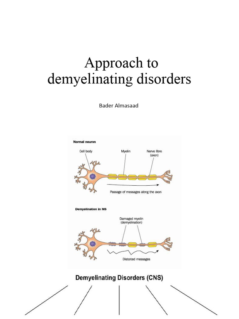 Approach To Demyelinating Disorders | PDF | Multiple Sclerosis | Human Diseases And Disorders