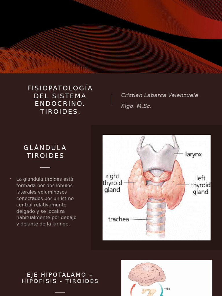 Fisiopatología Sistema Endocrino Tiroides. | Descargar gratis PDF | Tiroides | Hipertiroidismo