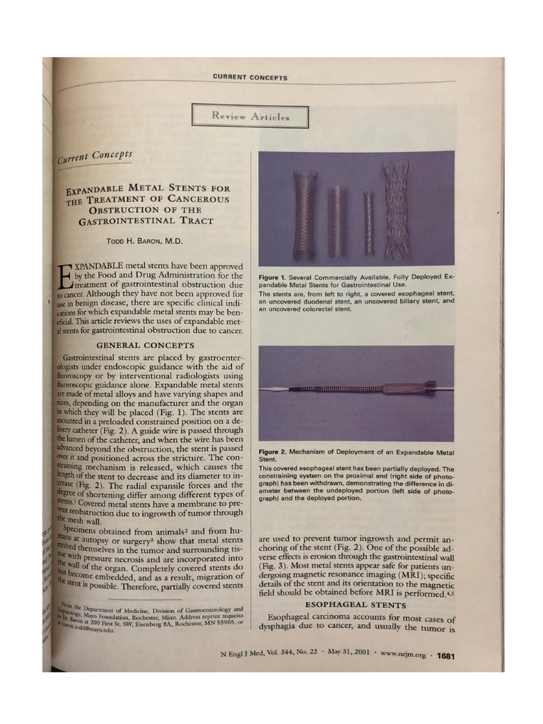 Expandable Metal Stents | PDF
