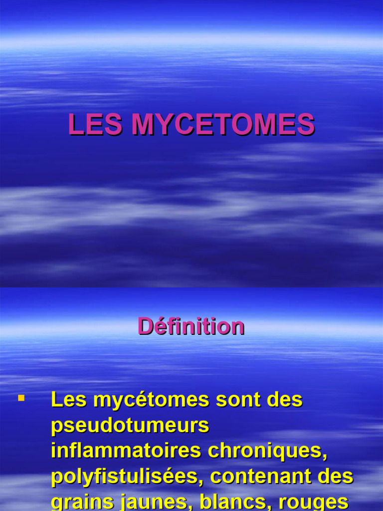 Mycétomes : Définition et Traitement | PDF | Maladies et troubles ...