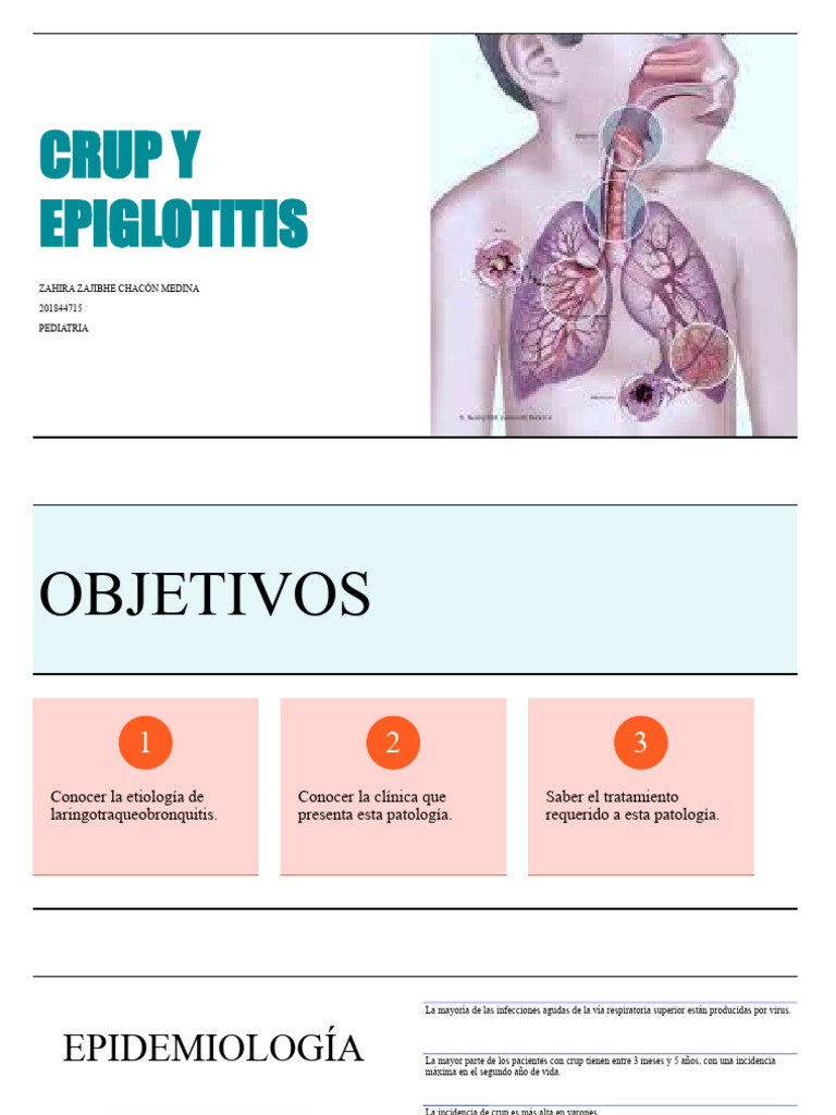 Crup y Epiglotitis - Zahira Chacon | PDF | Enfermedades y trastornos ...