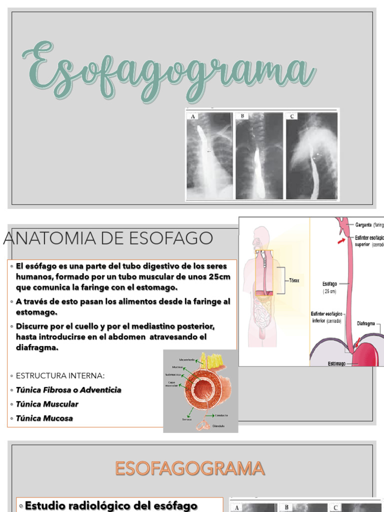 ESOFAGOGRAMA | PDF | Esófago | Medicina CLINICA