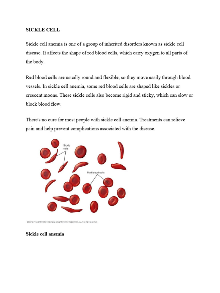 Sickle Cell | PDF | Anemia | Blood