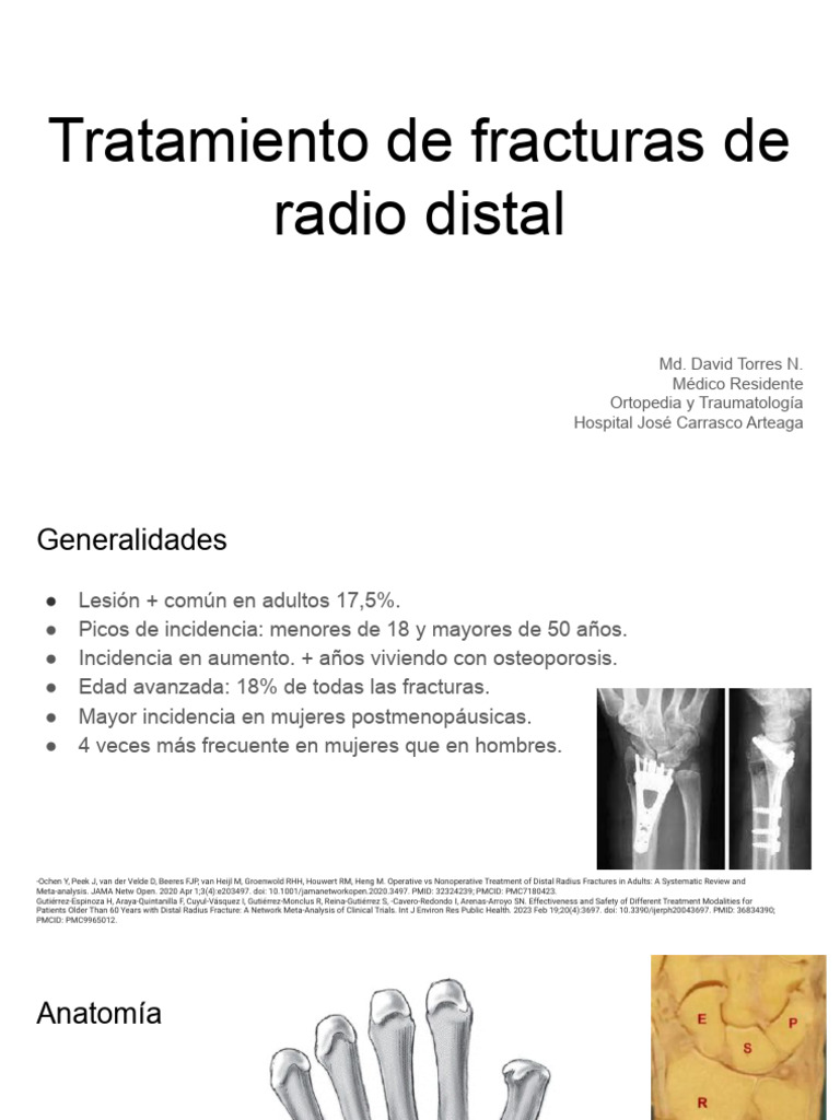 Manejo de Fracturas de Radio Distal | PDF | Especialidades Medicas ...
