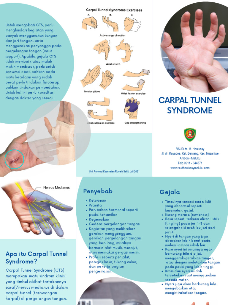 Leaflet - Carpal Tunnel Syndrome (CTS) - RSUD Dr. M. Haulussy | PDF