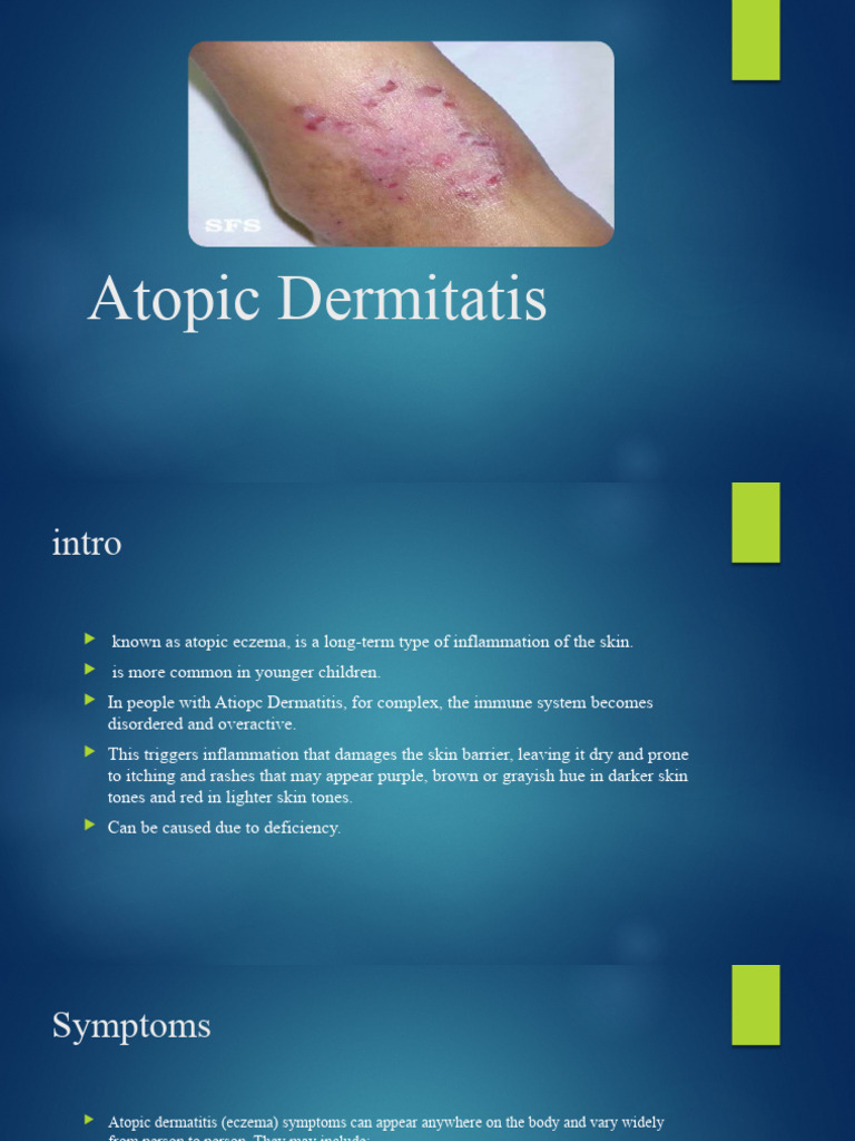 Atopic Dermitatis | PDF | Dermatitis | Topical Medication