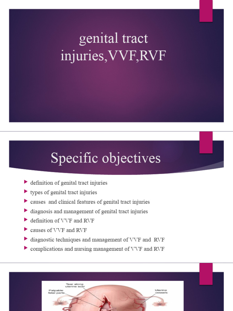 Genital Injury, VVF, RVF | PDF | Vagina | Childbirth