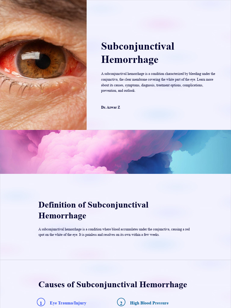 Tugas Azwar Subconjunctival-Hemorrhage | PDF | Bleeding | Injury