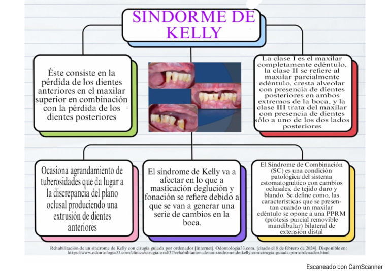 Síndrome de Kelly | PDF