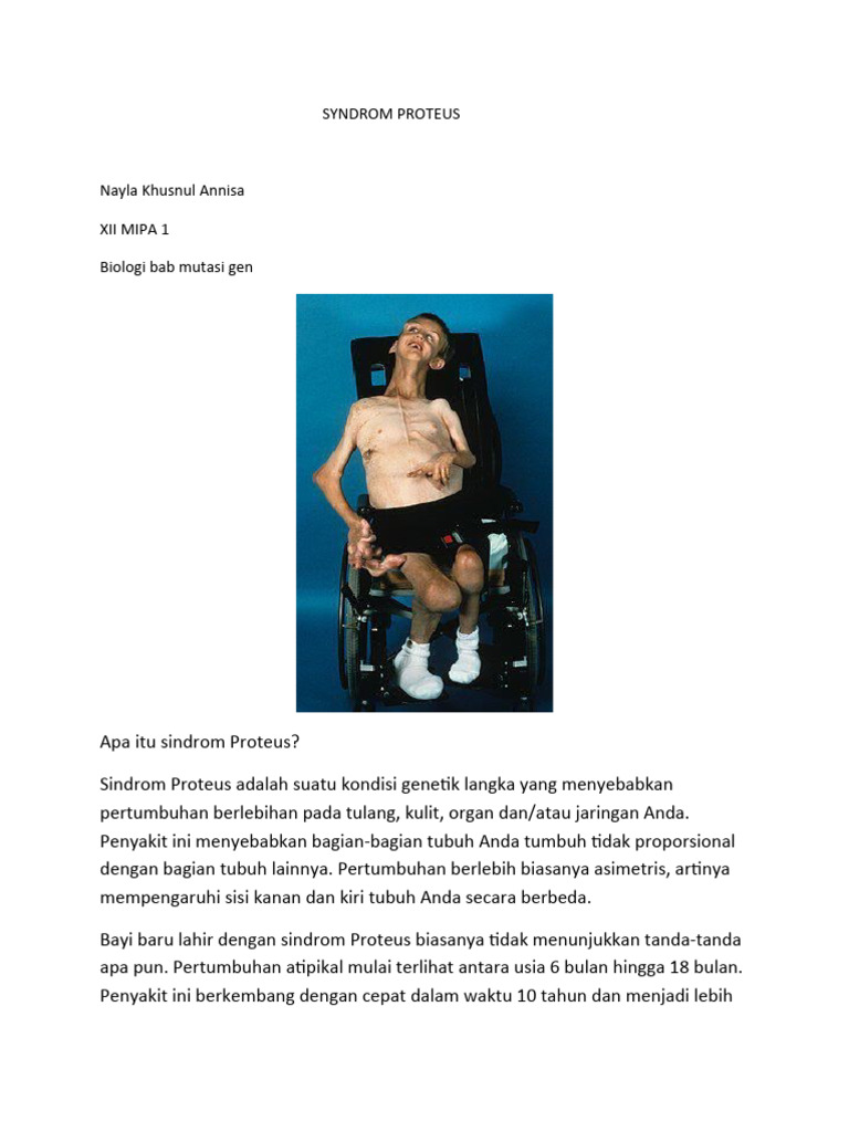 Nayla Khusnul - SYNDROME PROTEUS (Mutasi Gen) | PDF | Kesehatan Holistik | Sains & Matematika