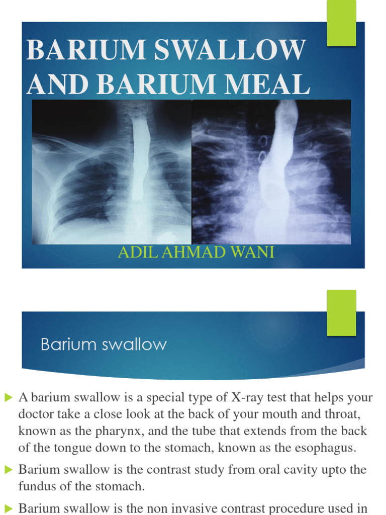 Barium Swallow and Meal Procedures | PDF | Esophagus | Stomach