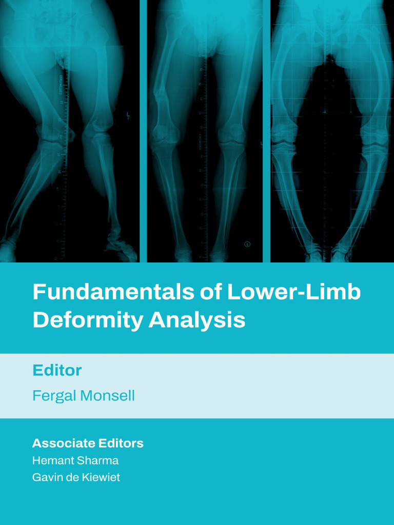 2022 Fundamentals of Lower Limb Deformity | PDF | Anatomical Terms Of ...