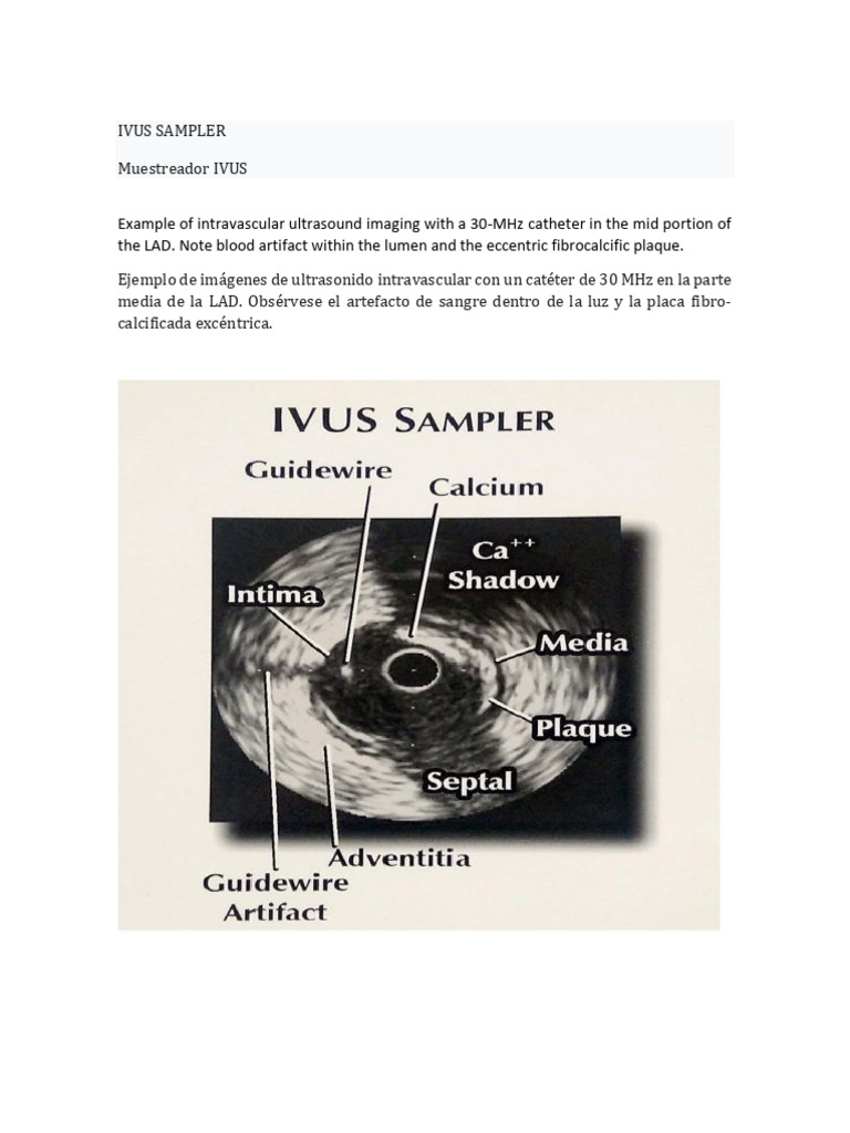 Guia Ivus | PDF | Angiología | Sistema circulatorio