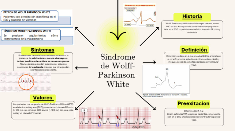 Síndrome de Wolff-Parkinson-White | PDF