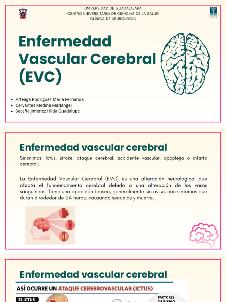 Enfermedad Vascular Cerebral (EVC) | Descargar gratis PDF | Carrera | Isquemia