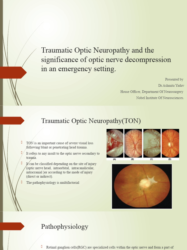 Traumatic Optic Neuropathy and The Significance of Optic | PDF | Injury ...