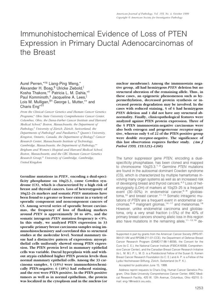 IHC Evidence of Loss PTEN Expression in Primary Ductal AdenoCa of ... IHC Evidence of Loss PTEN Expression in Primary Ductal AdenoCa of ...