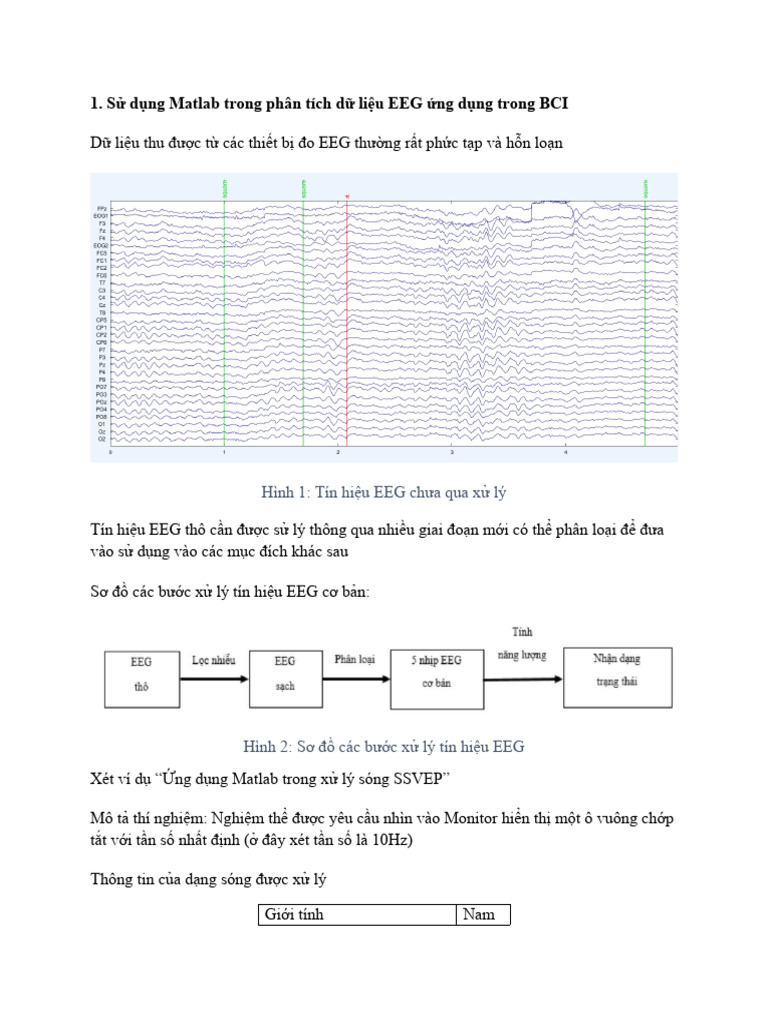 Sử dụng Matlab trong phân tích dữ liệu EEG ứng dụng trong BCI | PDF