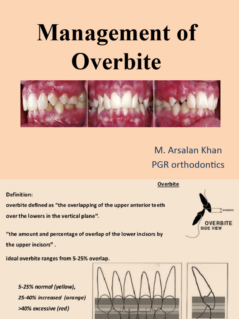 Overbite | PDF