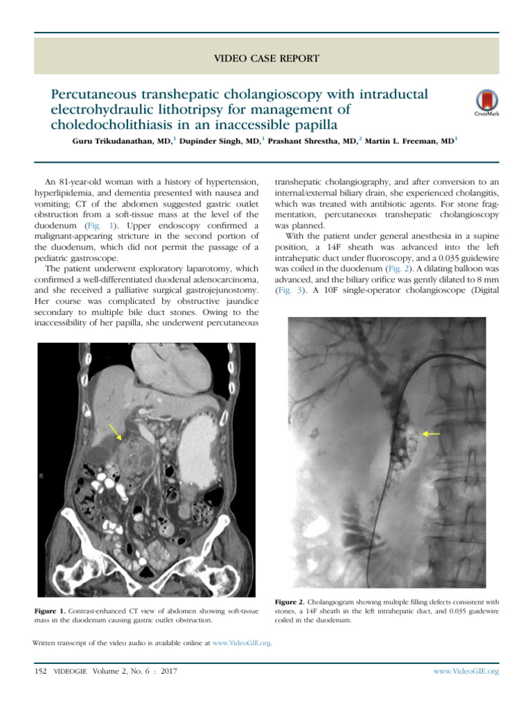 Percutaneous Transhepatic Cholangioscopy With Intr | PDF | Diseases And ...