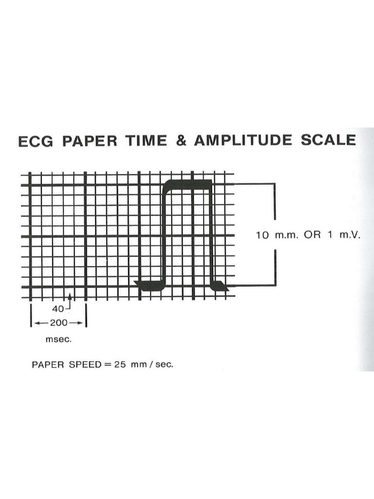 Ecg Calibration | PDF