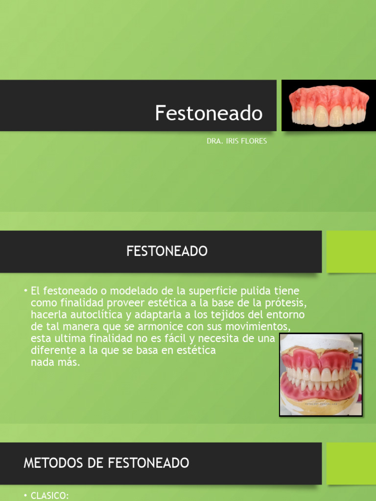 Festoneado | PDF | Dentadura postiza | Ramas de Odontología