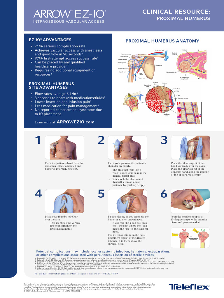 EZ-IO Proximal Humerus Poster PDF | PDF | Clinical Medicine | Musculoskeletal System