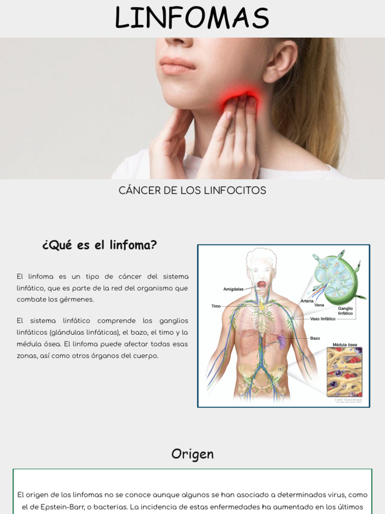 LINFOMAS | PDF | Ciencia y matemáticas