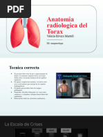 Cómo leer una radiografía de tórax | PDF | Tórax | Tórax (anatomía humana)