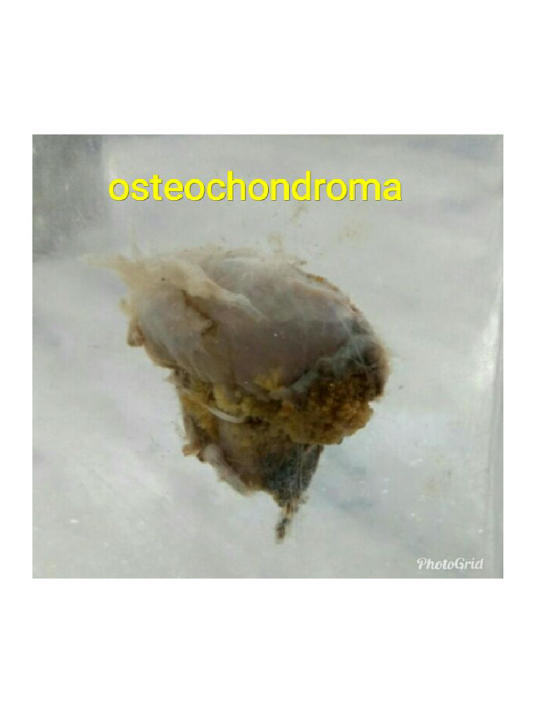 Patho Gross Specimen-1 | PDF