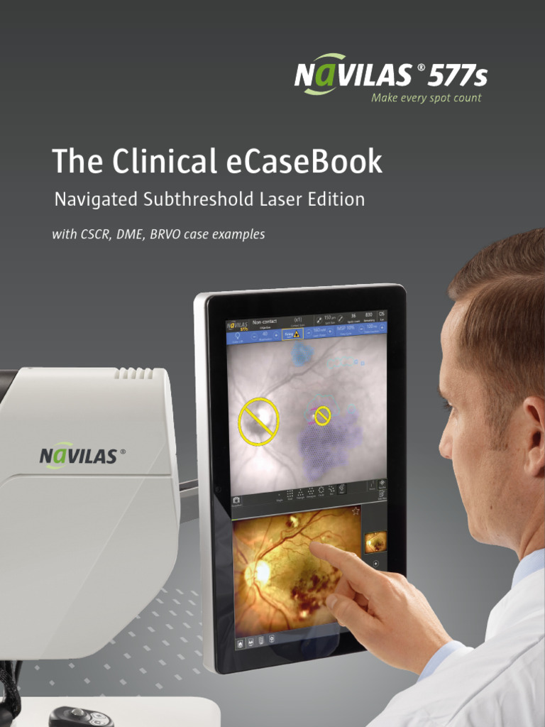 Navilas - The Clinical eCaseBook On Navigated Subthreshold Laser | PDF ...