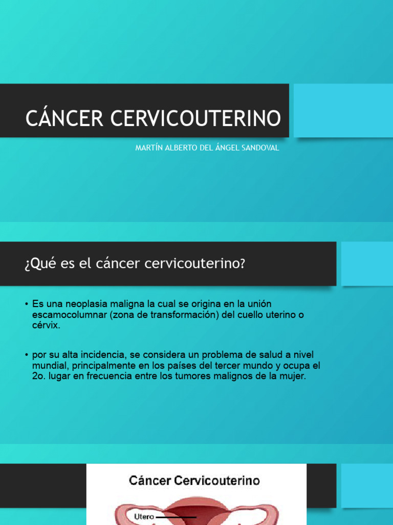 Cáncer Cervicouterino | PDF