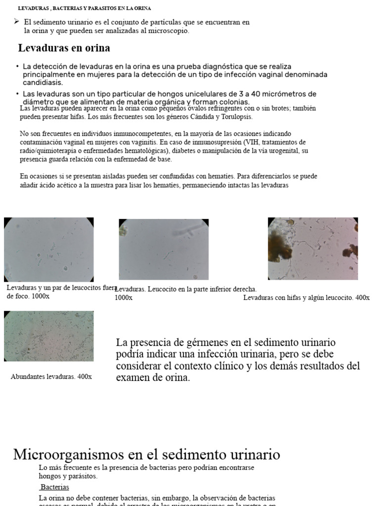 levaduras-y-par-sitos-en-la-orina-pdf-tuberculosis-microbiolog-a
