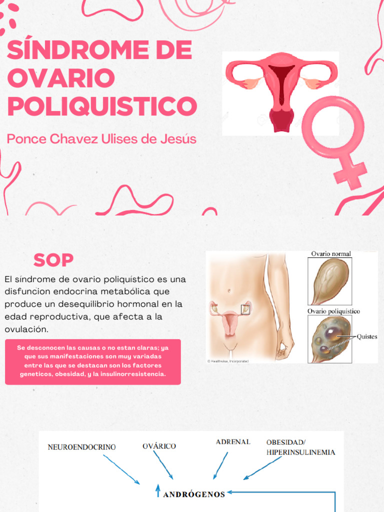 Sindrome de Ovarios Poliquistico | PDF | Obesidad | Sindrome de Ovario poliquistico