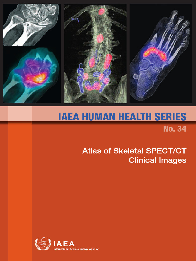 IAEA Atlas of Skeleton SPECT-CT | PDF