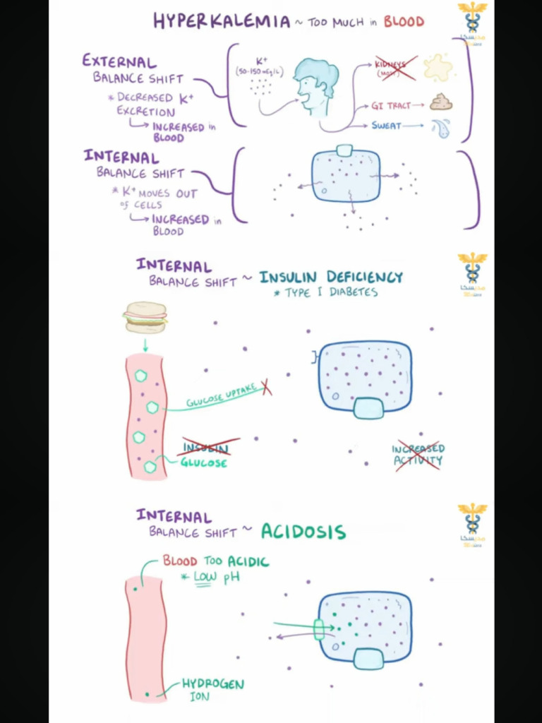 Hyperkalemia Pdf