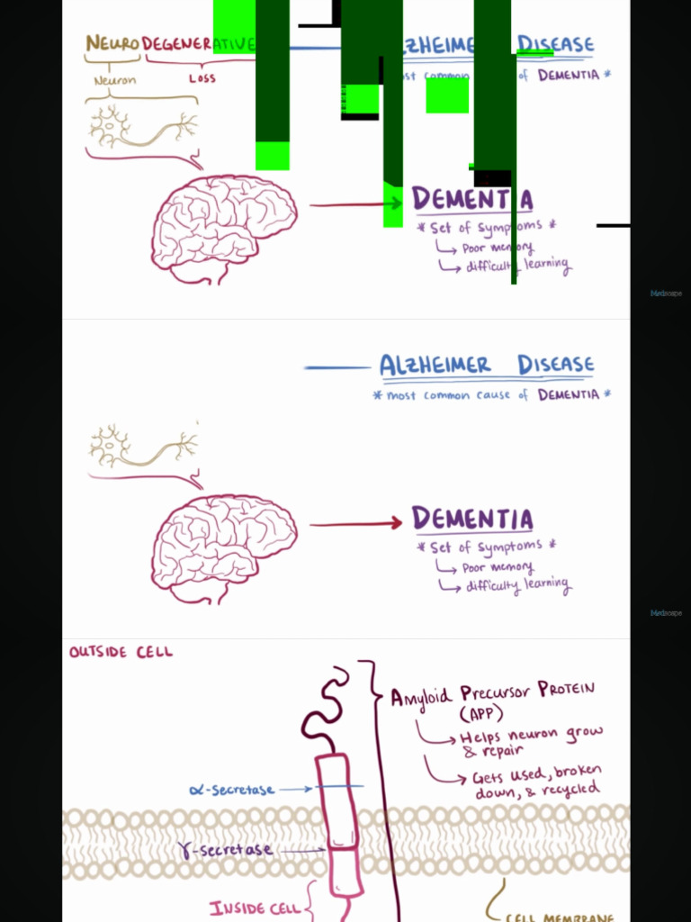 Dementia, Alzheimer's, Vascular Dementia | PDF