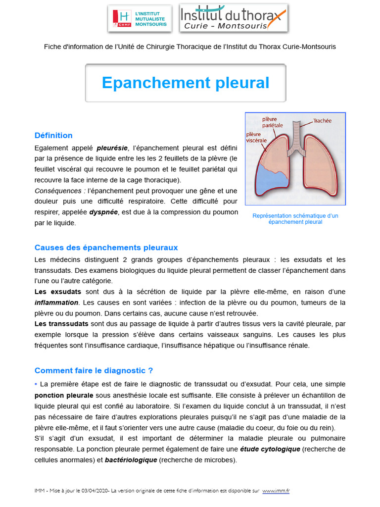 Épanchement pleural : diagnostic et traitement | PDF
