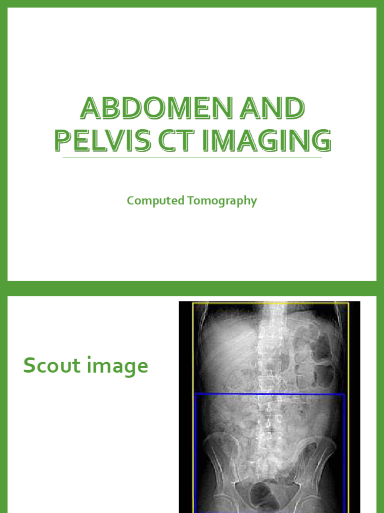 Abdomen & Pelvis CT Imaging | PDF | Ct Scan | Medicine
