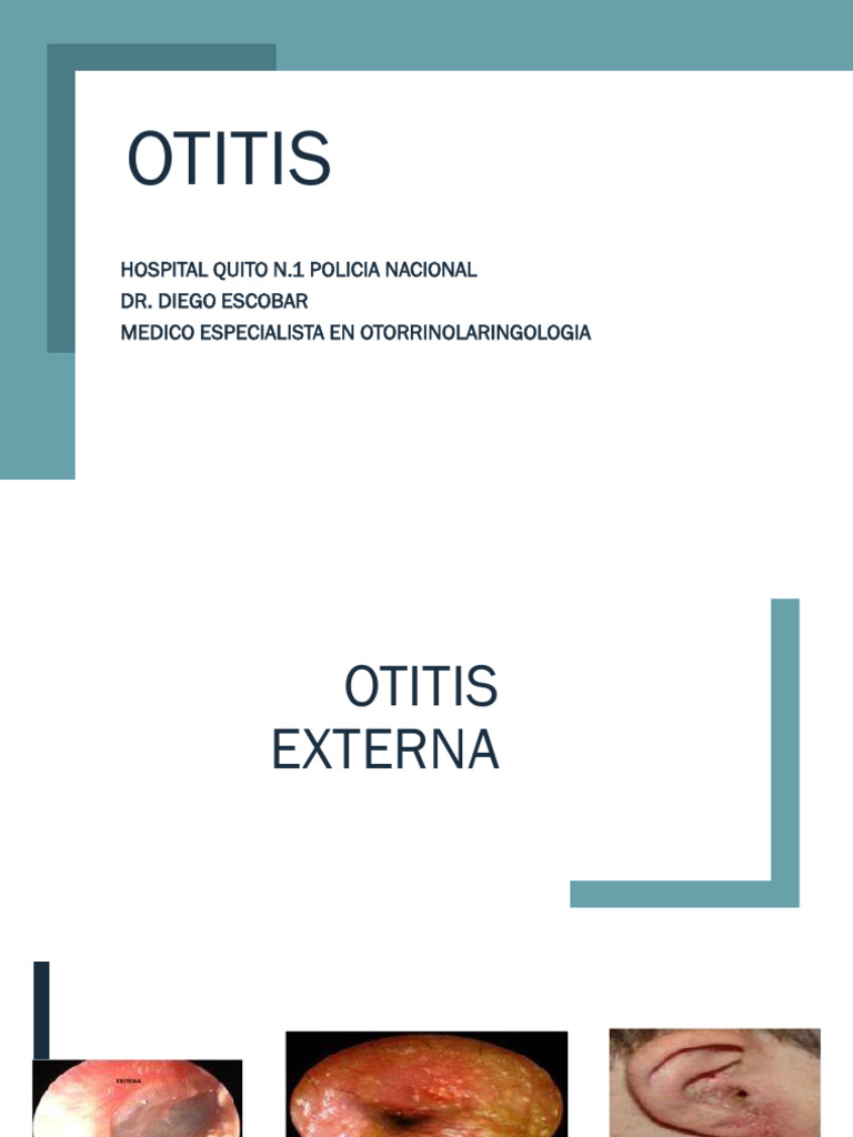 Otitis: Causas, Diagnóstico y Tratamiento | PDF