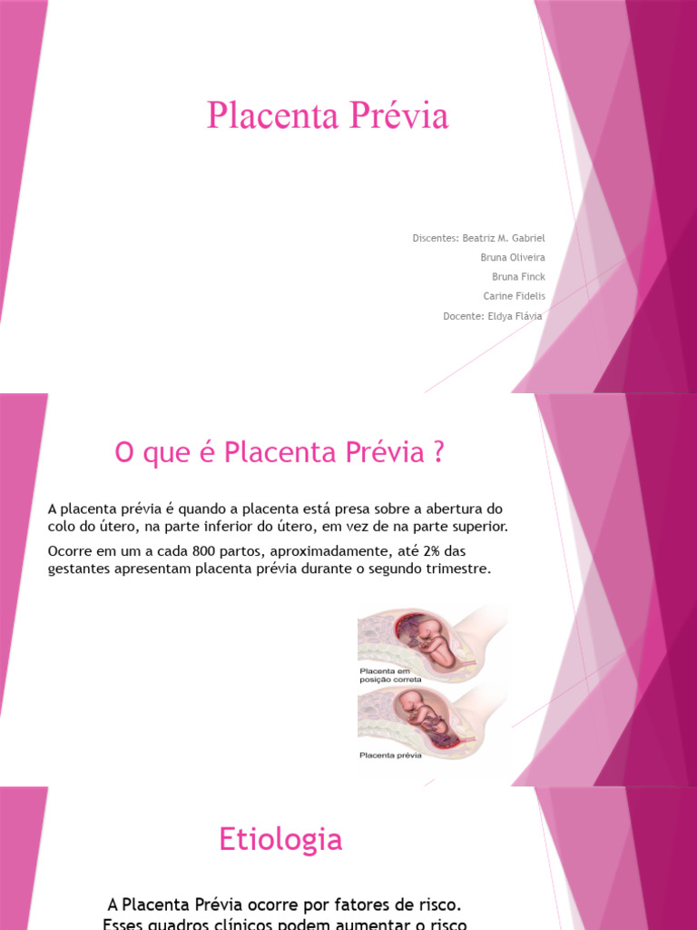 Placenta Prévia 2 | PDF